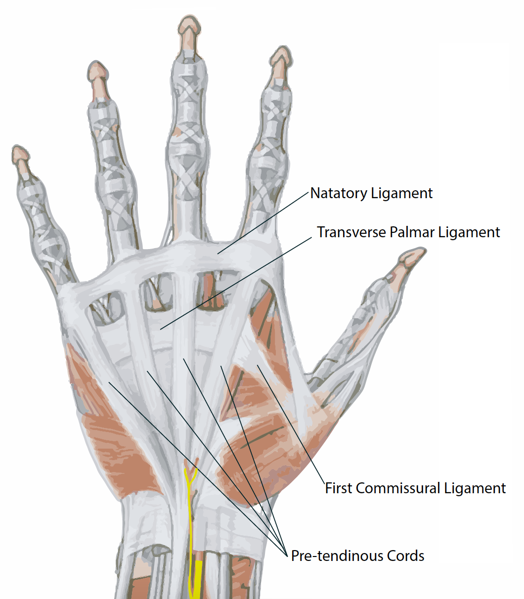 Dupuytrens Disease – Aberdeen Virtual Hand Clinic