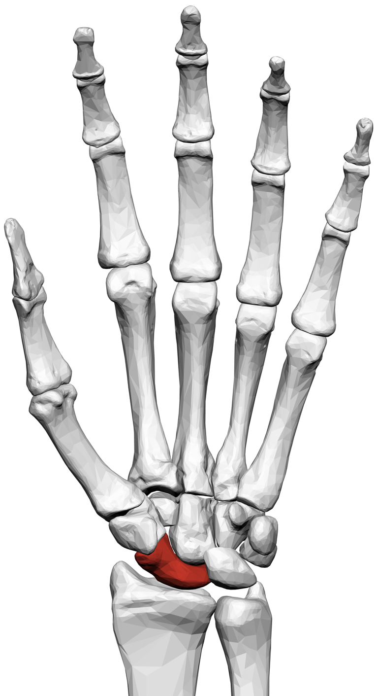 Scaphoid Fracture – Aberdeen Virtual Hand Clinic