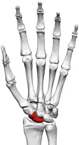 Scaphoid Fracture – Aberdeen Virtual Hand Clinic