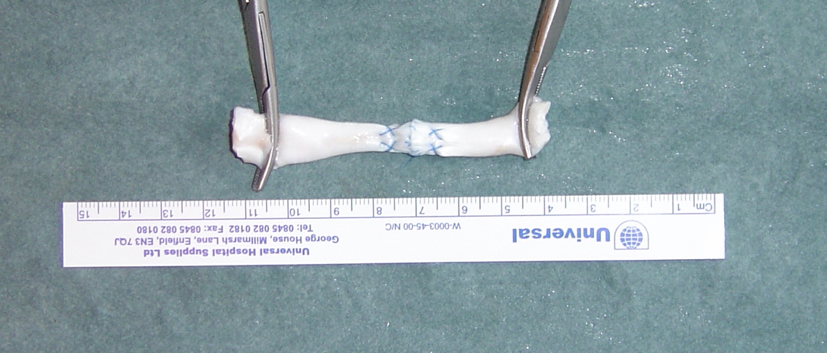 Flexor Tendon Injuries – Aberdeen Virtual Hand Clinic