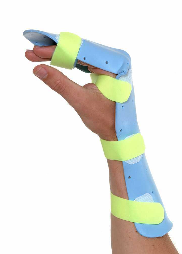 Flexor Tendon Injuries – Aberdeen Virtual Hand Clinic