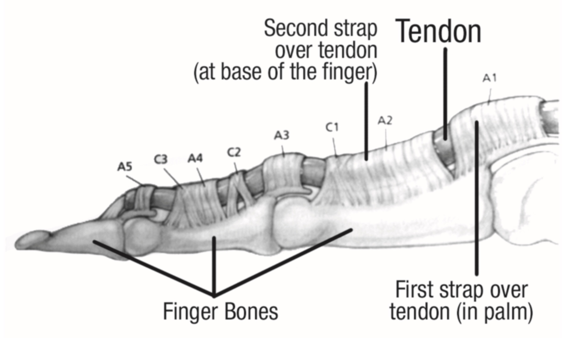 Ganglion Cysts – Aberdeen Virtual Hand Clinic